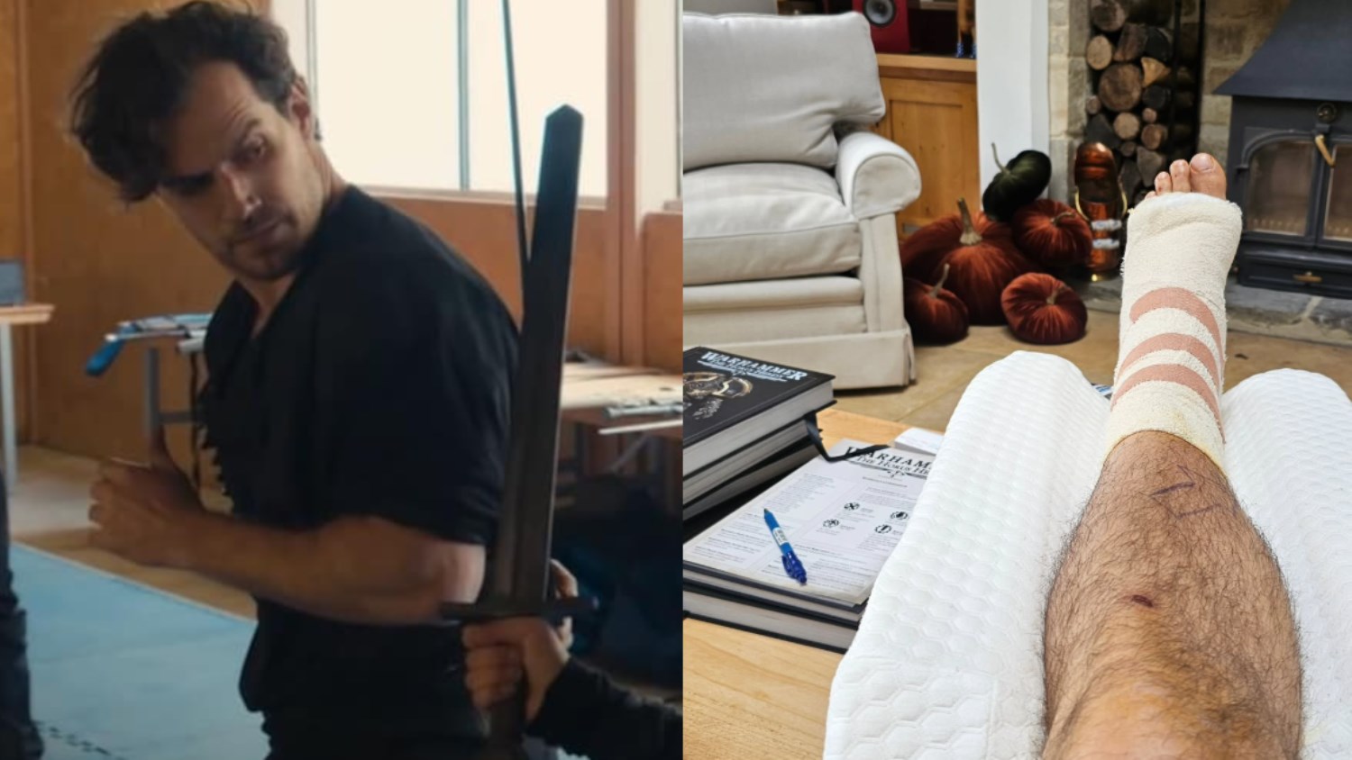 Henry Cavill Shares A Look At His HIGHLANDER Training Injury Which ...